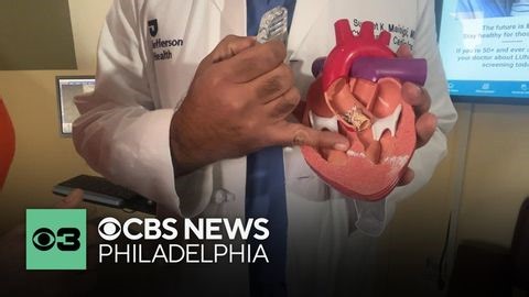 This pacemaker-like device is helping save heart disease patients' lives | Haystack News