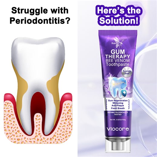 🧠 Struggling with gum pain, gum bleeding, swelling or receding gums? Rolimey® offers a revolutionary solution for gum health. Over 120,000 patients were successfully treated: ✔️ Treatment of gum infections and diseases ✔️ Bad Breath ✔️ Sensitive teeth and sensitive gums ✔️ Loose teeth and more 🇬🇧 Tested by the UK Dental Association, it's safe for everyone - even for those allergic to bee stings! Your key to effortless gum restoration: 🌿Important ingredients and 🏆benefits: 🐝Bee poison: 1️⃣ 