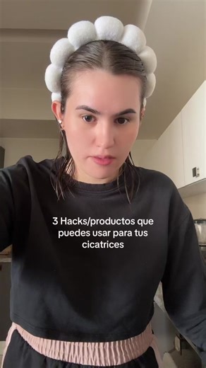 3 Hacks/productos para cicatrices de accidentes - Tratamiento efectivo