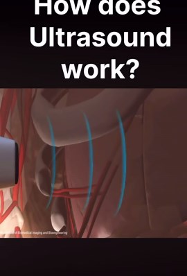 Scientifically how? on Instagram: "How does Ultrasound work: Ultrasound works by emitting high-frequency sound waves into the body using a transducer. These sound waves reflect off tissues and return as echoes. The transducer captures these echoes, and the ultrasound machine processes them to create real-time images of the internal structures. #ultrasound #pregnancy #babybumplove #trending #science #fact #health #viral #reels #video #viralvideos #reelsinstagram #image"