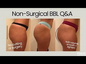 Non-Surgical BBL Patient Q&A: Why Choose Fillers Over a Knife?