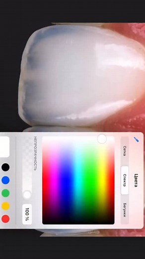 A short video from my MiYO course 🔥🔥 🦈 🦈🦈 🦈🦈 🦈🦈 🦈🦈 🦈🦈 🦈🦈 🦈 🚶‍♂️‍➡️ Visit my page, there’s a lot of educational content there, including free stuff 🙏👍 💌Follow 👉@akulova_1990 — learn to be a TOP technician in just 5 minutes a day | Akulova Anna