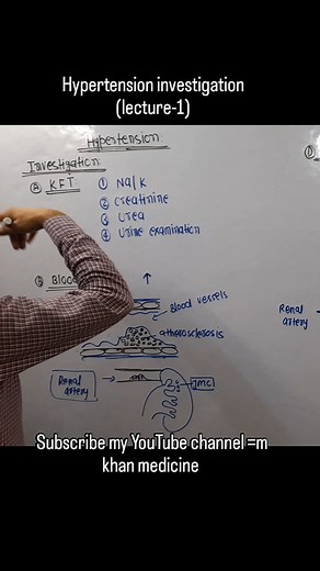 84K views · 3.1K reactions | Hypertension investigation (lecture-1) . . . . . . . . . #Hypertension #investigation #hypertensionawareness #hypertensioninvestigation #drugs #reel #reels #reelvedio #reelsvedio #viral #viralvedio #viralreel #trending #trendingreel | Mujahid Khan | Facebook