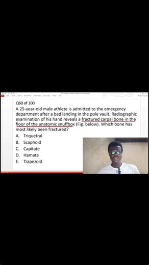 Dr Tes on Instagram: "In this video, I discussed the anatomy of the anatomical snuffbox, its location, boundaries and its associated clinical correlates. We have a patient that had a fracture at the anatomical snuffbox due to poor landing during a pole vault. We went through the radiographic imaging and made the correct diagnosis. Enjoy! 🤩🤩 - - - - - #anatomy #medicine #surgery #fypage #learn #medical #university #medschool"
