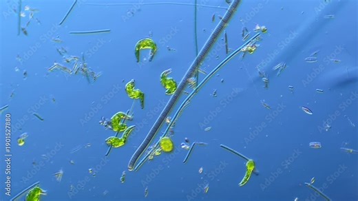 Euglena and other microorganisms under the microscope at 100x Magnification