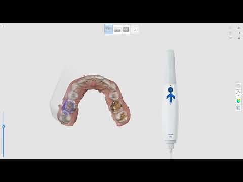 Scan Strategy_Mandible (ENG)