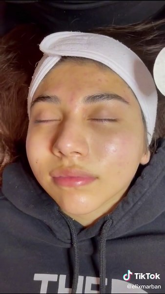 #Dermaplaning gets rid of dead skin cells, #microdermabrasion helps with pigmentation on skin, leaving a #glowingskin reducing large pores! #facial