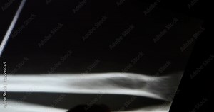 4k doctors study arm,leg&palm joints skeleton bone X-ray film for analysis on touch screen equipment.health medical hospital.