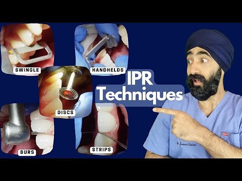 IPR: Ultimate Review Video of Different Techniques and Methods for GDPs