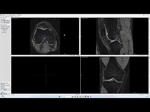 Mastering ITK-SNAP: Session #2 [Manual Segmentation of MRIs]