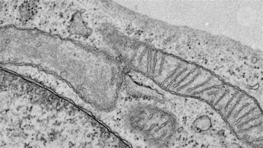New research in Nature showing mitochondria can split into two different forms resolves a longstanding mystery of how mitochondria can simultaneously provide cells with energy and essential building blocks, even when resources are limited. Read the paper: https://go.nature.com/40LeBW3 | Nature Portfolio