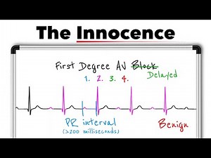 First-Degree AV Block Explained | ECG Interpretation, PR Interval & Clinical Significance