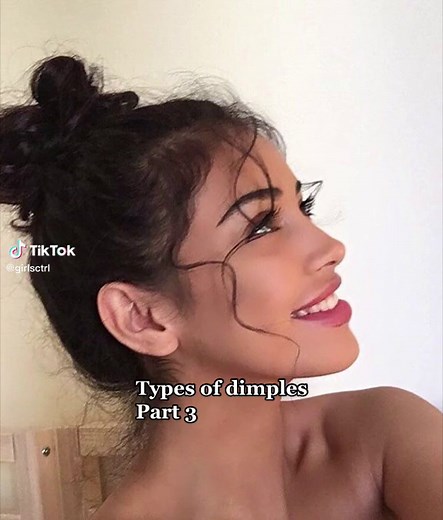 soo cute #foryoupage #fyp #girlsctrl #typesofdimples #dimples #whiskerdimples #indiandimples