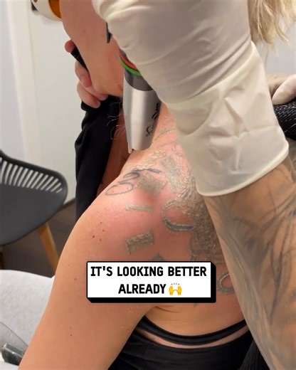 I regretted my tattoo so much #beauty | UNILAD