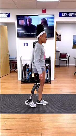 Custom Prosthetic for PFFD | Amelia’s Rotationplasty Transformation