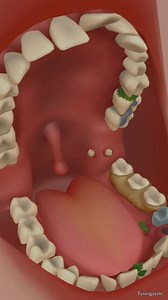 Cavity_teeth #animation #shortsfeed #shortvideo #shorts #teethcleaning #viralreelsシ #fbreelsvideo #facebookreelsviral #asmrvideo #shortvideofbreels #reelsviralfb Tunnig ASMR | Tunnig ASMR