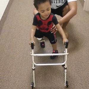 Watch This Adorable 2-Year-Old Walk for the First Time After Losing His Right Foot and Left Leg
