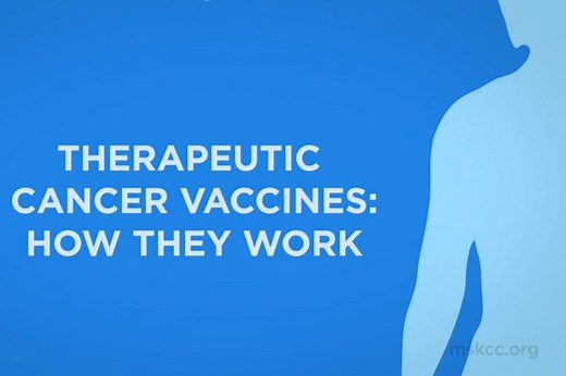 Therapeutic Cancer Vaccines: How They Work