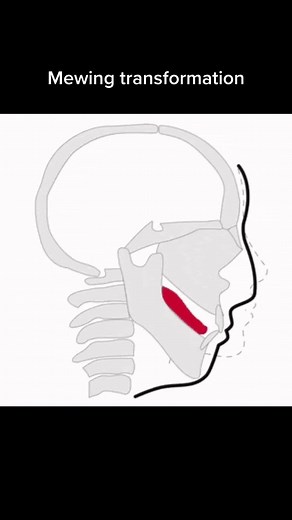 Jawline Transformation with Mewing Technique