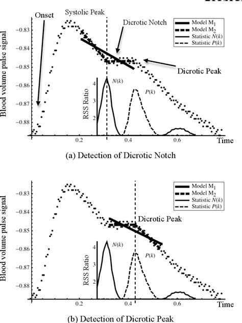 figure 1 from multi resolution linear model comparison for detection of dicrotic notch and peak