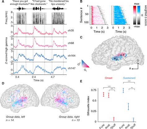 figure 1 from a spatial map of onset and sustained responses to speech in the human superior