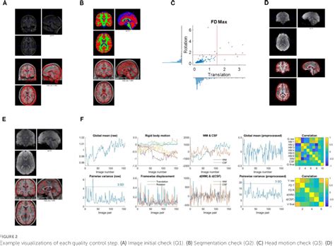 Figure From A Functional Mri Pre Processing And Quality Control