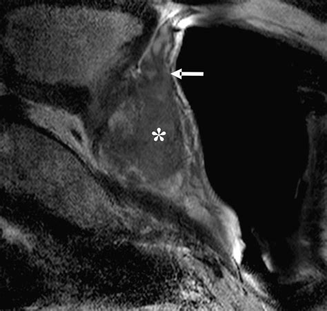 New Horizons In Prostate Cancer Imaging European Journal Of Radiology
