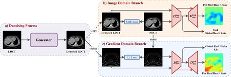 du gan generative adversarial networks with dual domain u net based discriminators for low dose