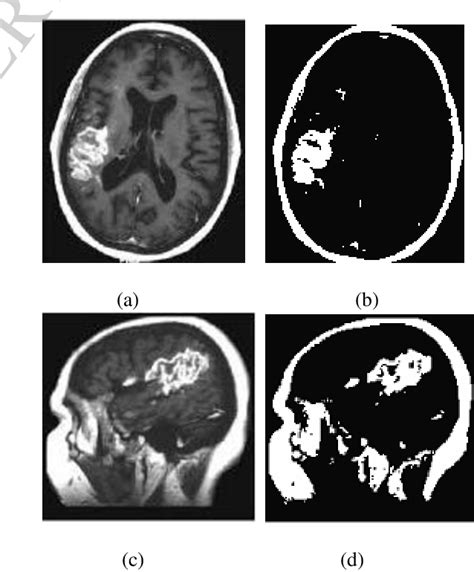 figure 2 from a modified adaptive fuzzy c means clustering algorithm for brain mr image