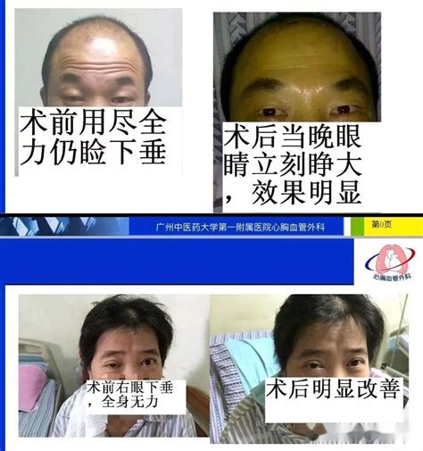 战胜肌无力一起向未来一位重症肌无力女性的自述 知乎