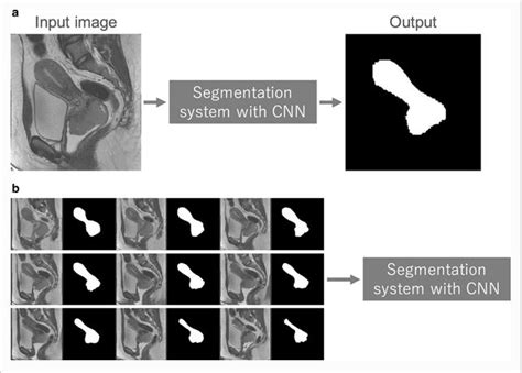convolutional neural networks an overview and application in radiology ai blog