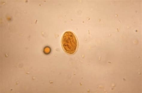 Imagine Gratuit Photomicrograph Giardia Lamblia Chist Trichrome Pata