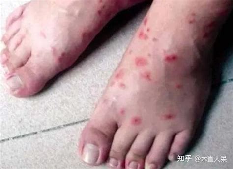 外侵物种红火蚁的识别危害以及防治方法 知乎