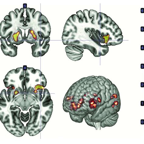 statistical non parametric map of significant clusters correlating to download scientific