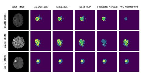 github risc mi braintumor ddpm using learned visual representations from diffusion models for
