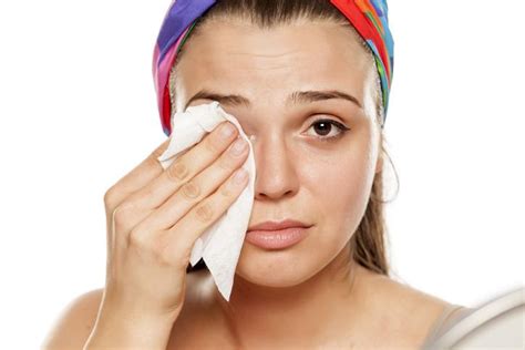 Perrillas En Los Ojos Por Qué Salen Y Cómo Quitarlas