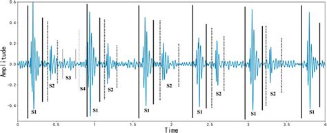 frontiers heart sound classification based on improved mel frequency spectral coefficients and