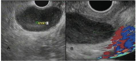 Gastroenterol Res