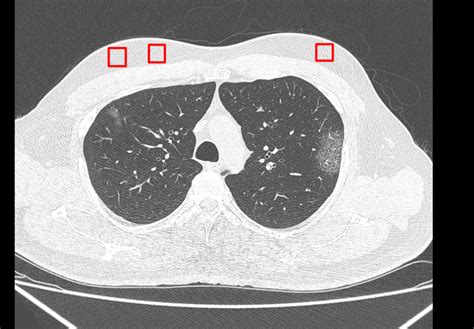 select area square with spicific measure from an image using skimage python stack overflow
