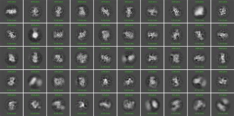 overfitting in refinements 3d reconstruction cryosparc discuss