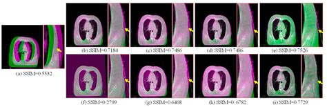 applied sciences free full text adaptive visual saliency feature enhancement of cbct for