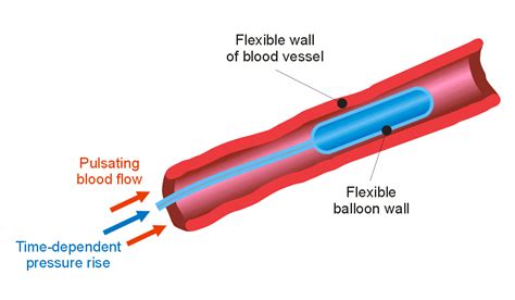 fluid structure interaction asd gmbh