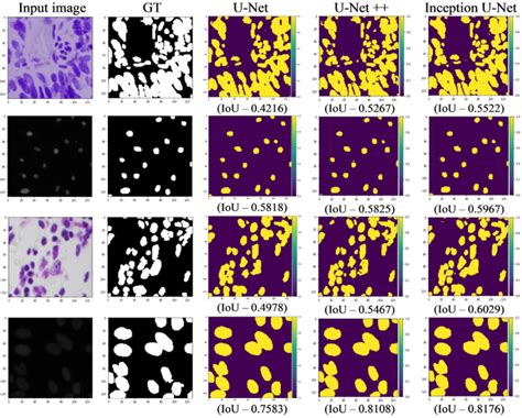inception u net architecture for semantic segmentation to identify nuclei in microscopy cell