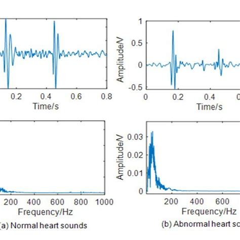 typical records of normal and abnormal heart sounds download scientific diagram