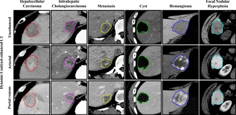 frontiers automatic detection and classification of focal liver lesions based on deep
