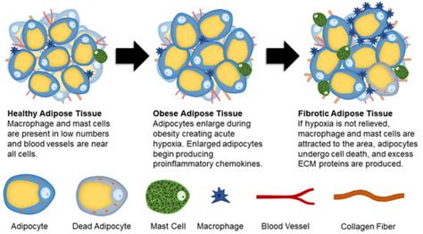 IJMS Free Full Text Adipose Tissue Fibrosis Mechanisms Models