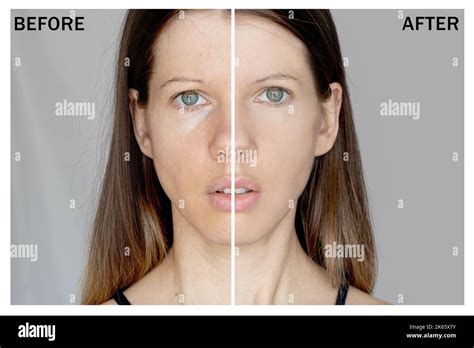 Before After Woman Hair Fotos Und Bildmaterial In Hoher Auflösung Alamy