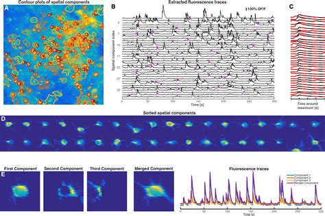 simultaneous denoising deconvolution and demixing of calcium imaging data neuron