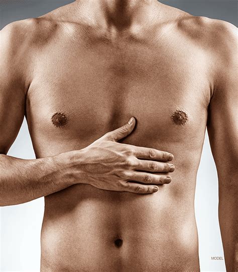 Transgender Procedures El Paso TX Frank Agullo MD