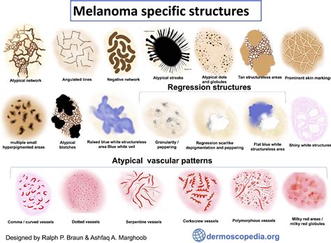 Dermatoscopy Clinics In Dermatology